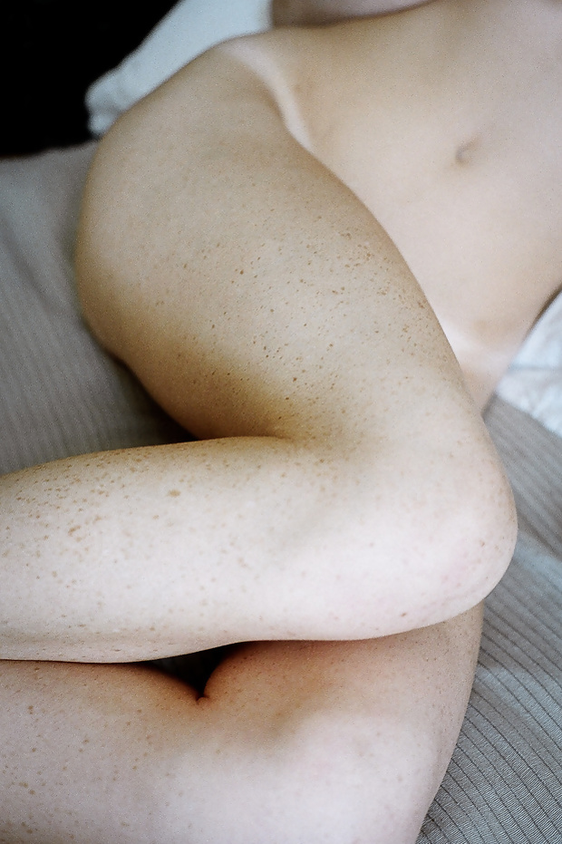 Beautiful Freckled Girls Pic Of 72
